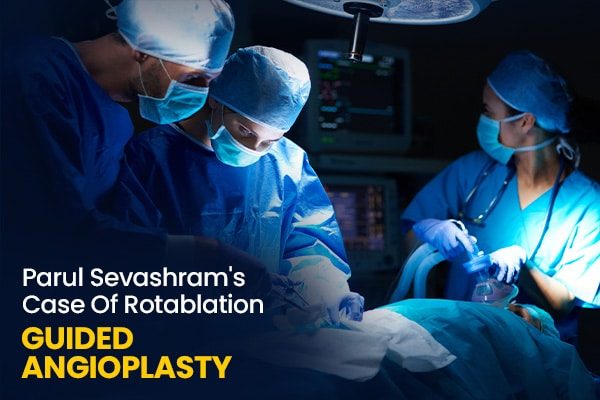 Case Study of Rotablation Guided Angioplasty | Parul Hospital